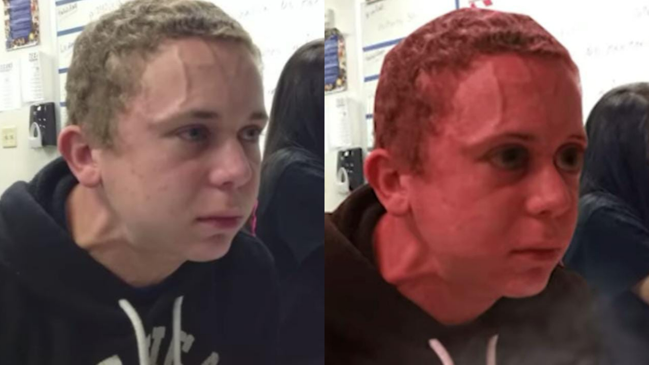 ¿Lo recuerdas? Así luce ahora el chico del meme de la vena saltada